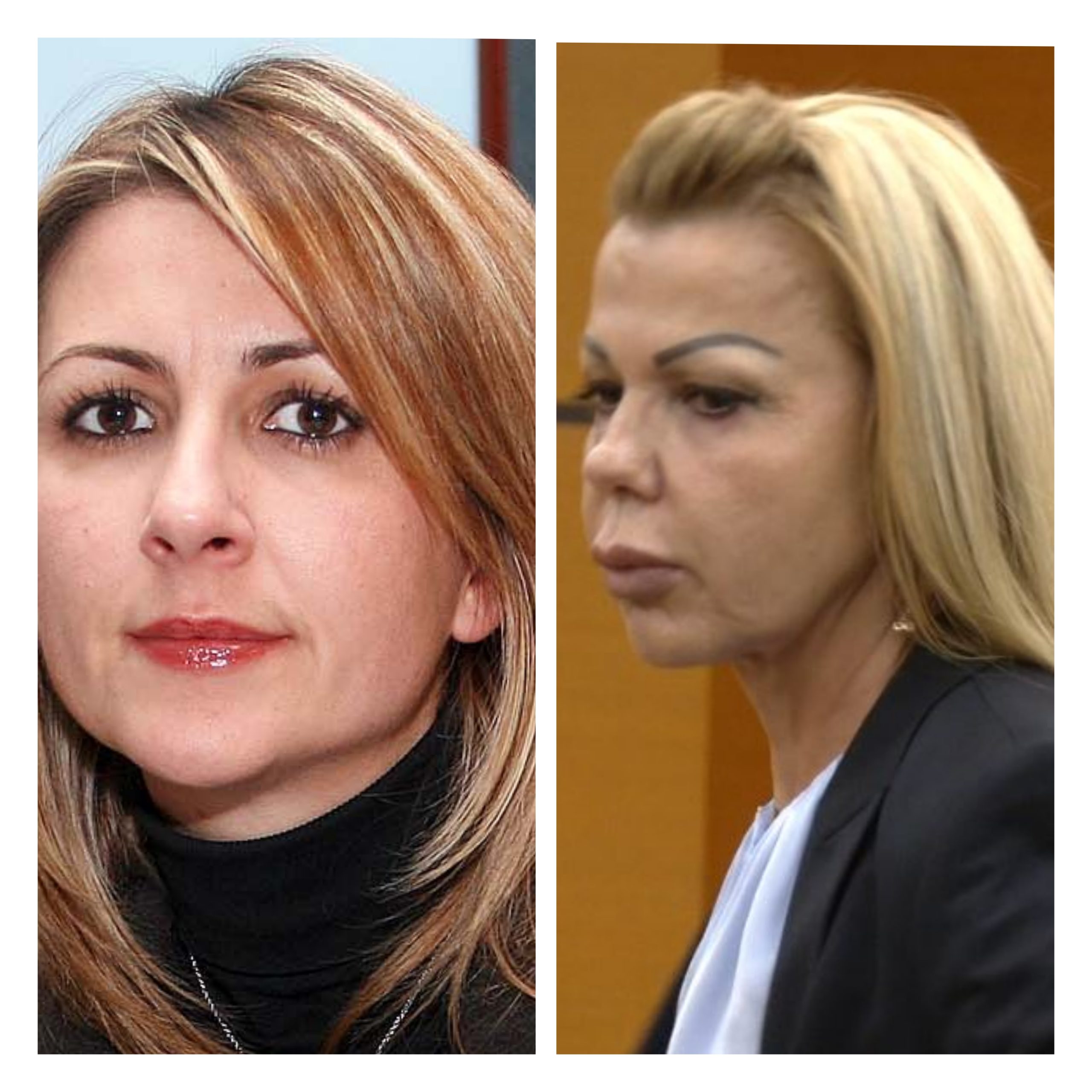 Prapaskena | Prapaskena